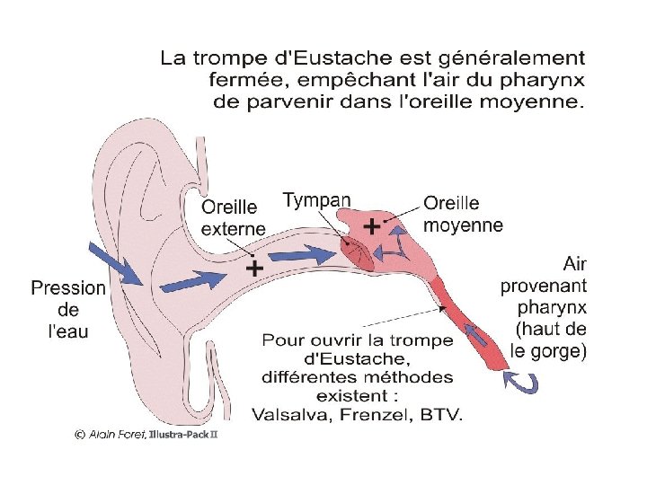 Barotraumatismes Les oreilles La surpression pulmonaire Les sinus