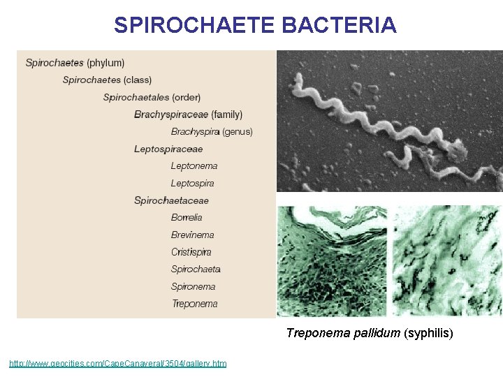 SPIROCHAETE BACTERIA Treponema pallidum syphilis http www geocities
