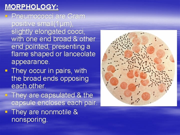 Streptococcus pneumoniae Dr Mohammed Shaker Head Dept of