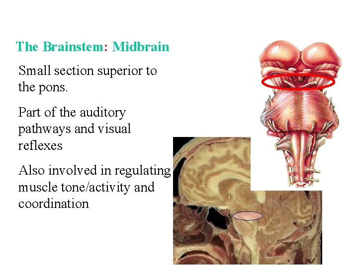 Diencephalon Sits on top of the brain stem