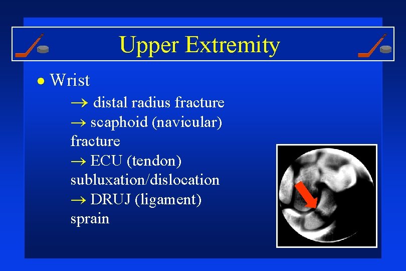 Upper Extremity Shoulder acromioclavicular AC separation glenohumeral ...
