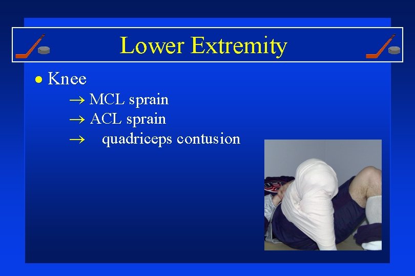 Upper Extremity Shoulder acromioclavicular AC separation glenohumeral ...