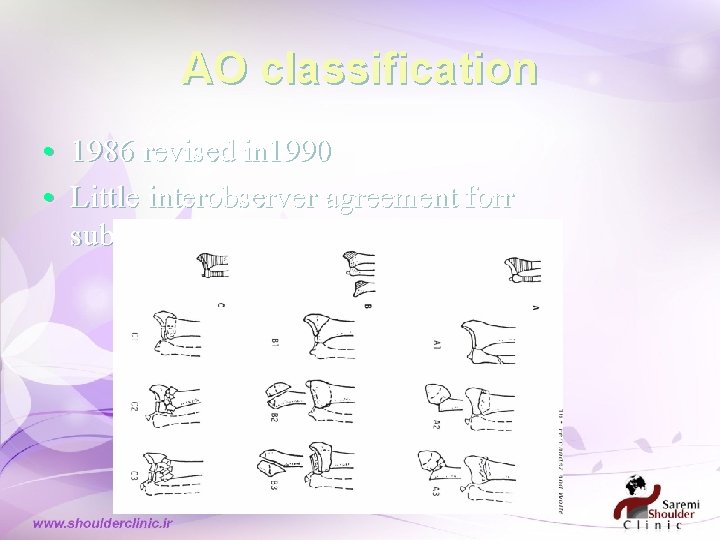 Classification of distal radius fx H Saremi MD