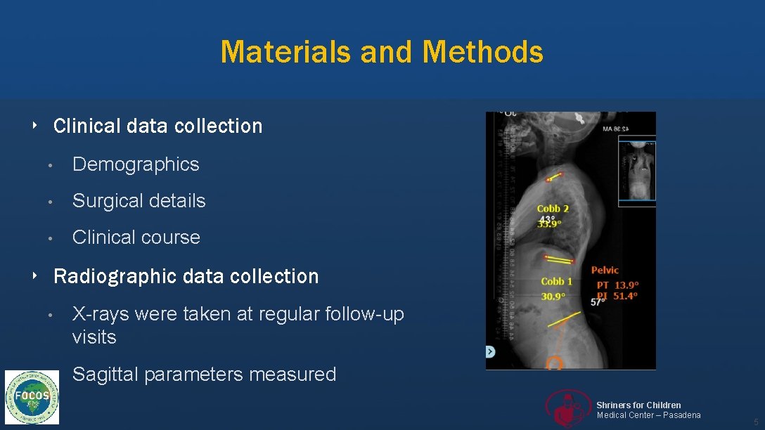 Sagittal Balance In Hyperkyphotic Patients With Growing Rods