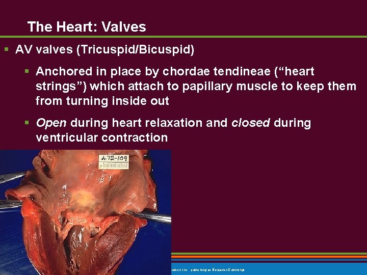 Cardiovascular System A closed system of the heart