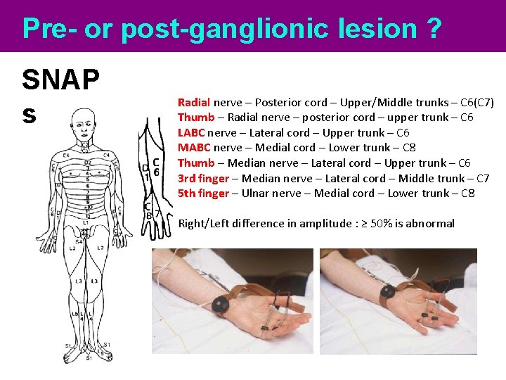 ENMG of Brachial Plexus F Wang To exclude