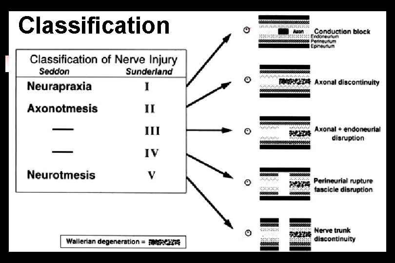 Peripheral Nerve Injury Basar Atalay M D YEDITEPE