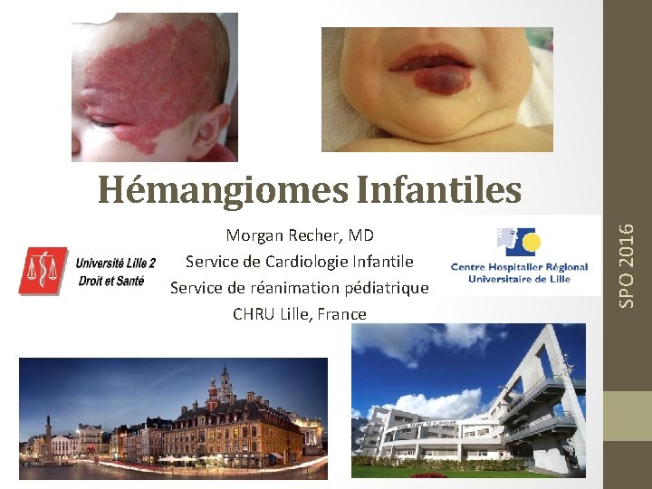 Morgan Recher MD Service de Cardiologie Infantile Service