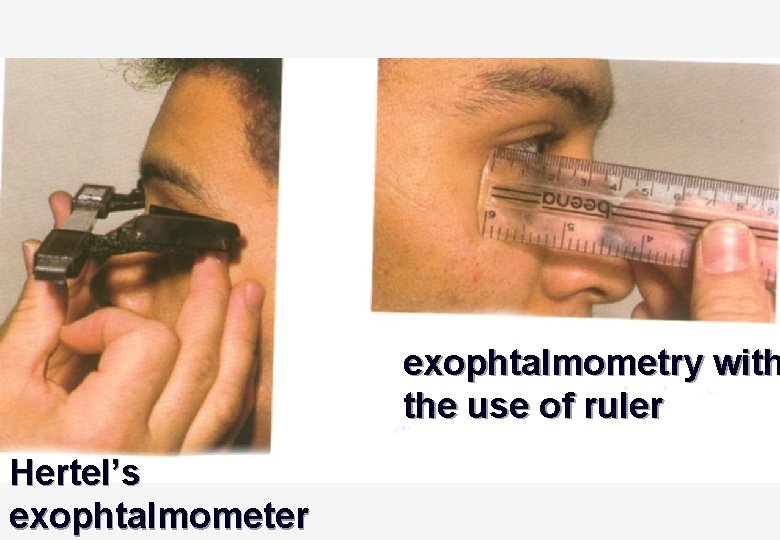 Anatomy of the eye from the clinical point