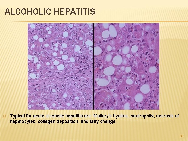 DISEASES OF THE LIVER GALLBLADDER AND PANCREAS V