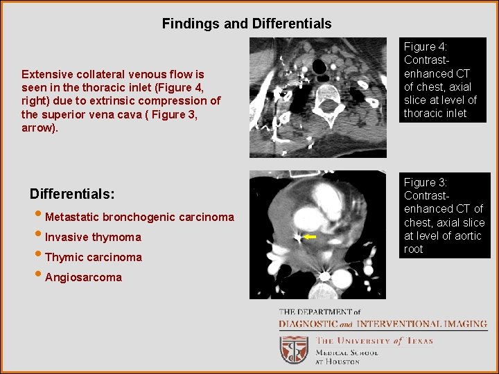 Radiological Category Thoracic Chest Principal Modality 1 CT