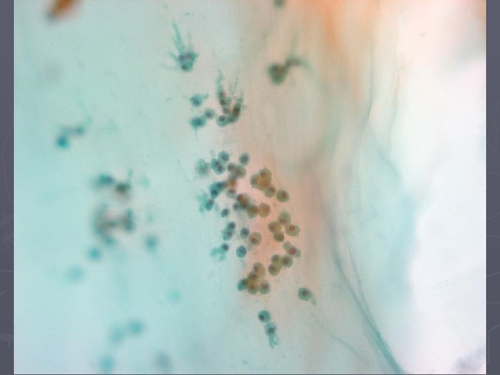 Microscopic finding Mucinous background Low cellularity Isolated or