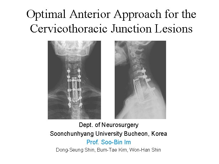 Optimal Anterior Approach for the Cervicothoracic Junction Lesions