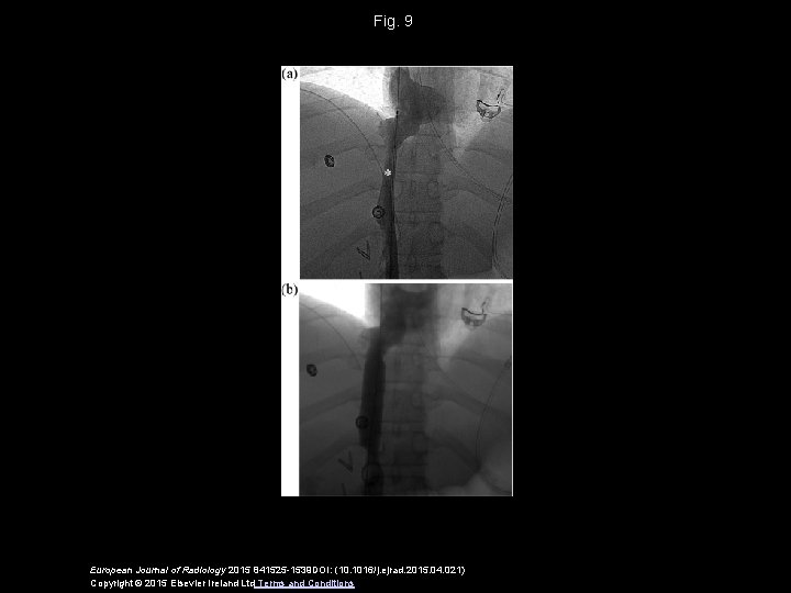 Assessment of surgical portosystemic shunts and associated complications
