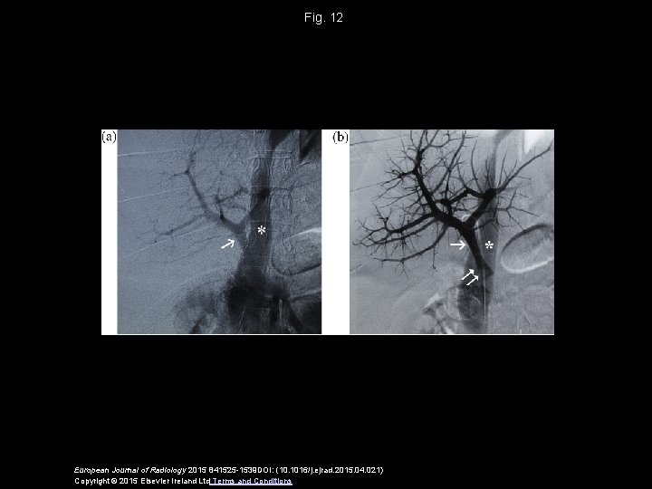 Assessment of surgical portosystemic shunts and associated complications