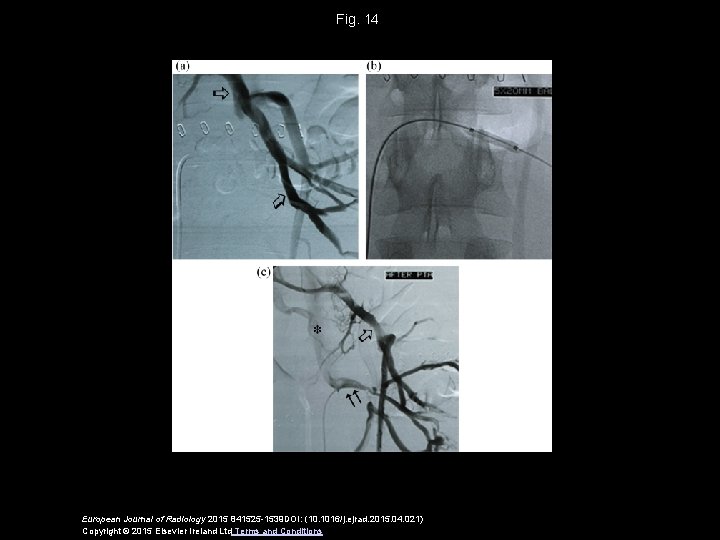 Assessment of surgical portosystemic shunts and associated complications