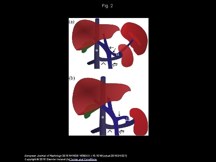 Assessment of surgical portosystemic shunts and associated complications
