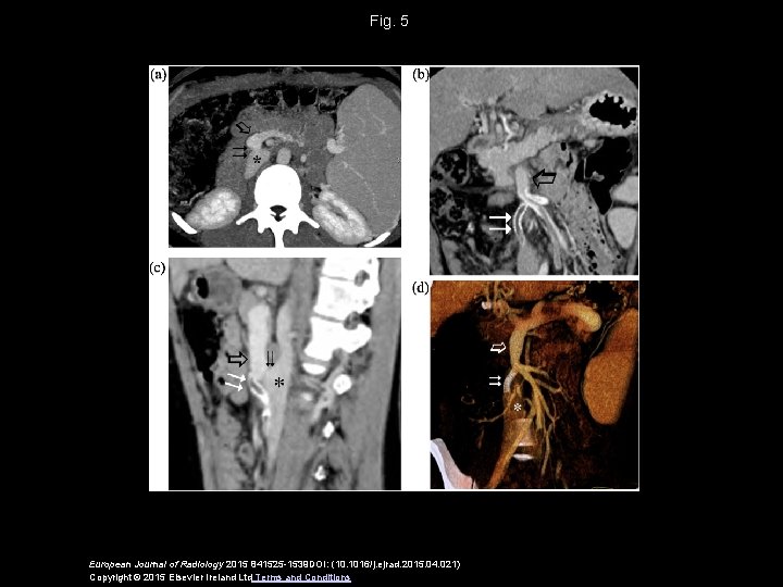 Assessment of surgical portosystemic shunts and associated complications
