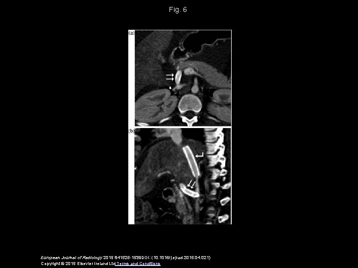 Assessment of surgical portosystemic shunts and associated complications