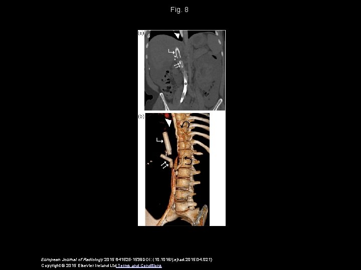 Assessment of surgical portosystemic shunts and associated complications