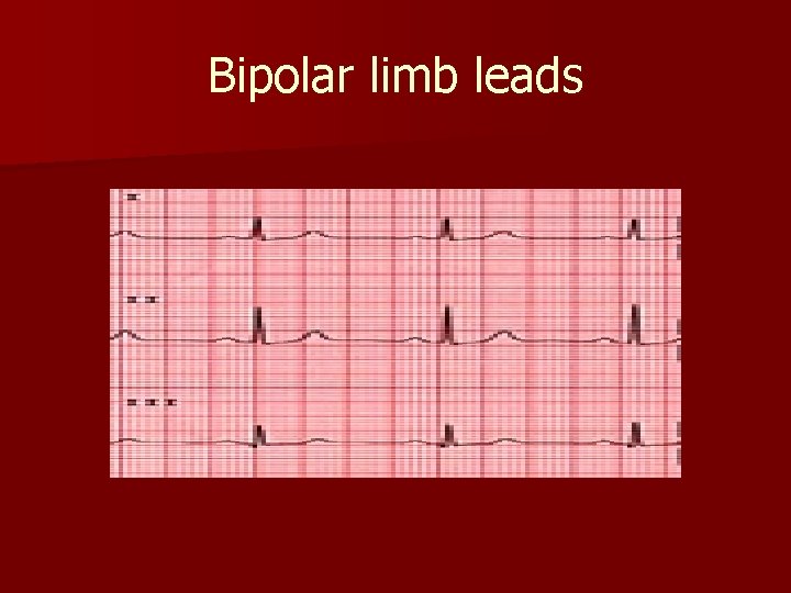 Electrocardiography investigation of heart ECG Elecrtocardiogram n It