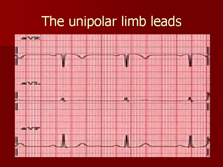 Electrocardiography investigation of heart ECG Elecrtocardiogram n It
