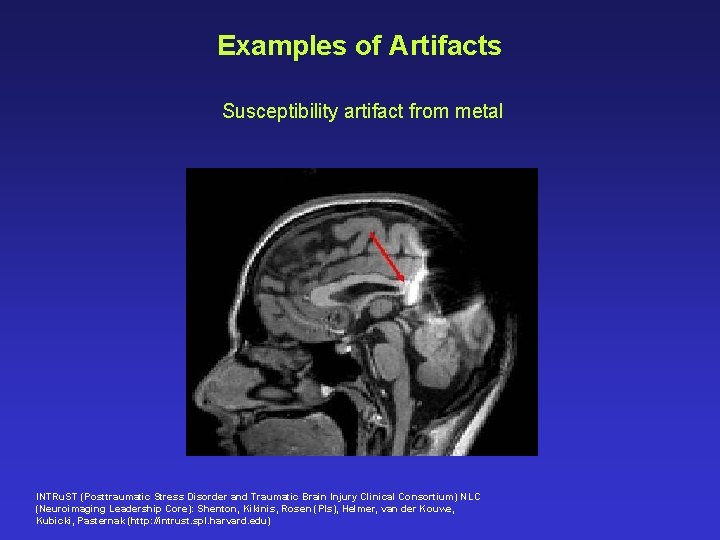 MRI Acquisition Methods for Brain Morphometry Andr J