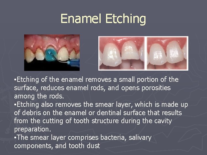 Principles of Bonding Chapter 5 DEN 256 Dental