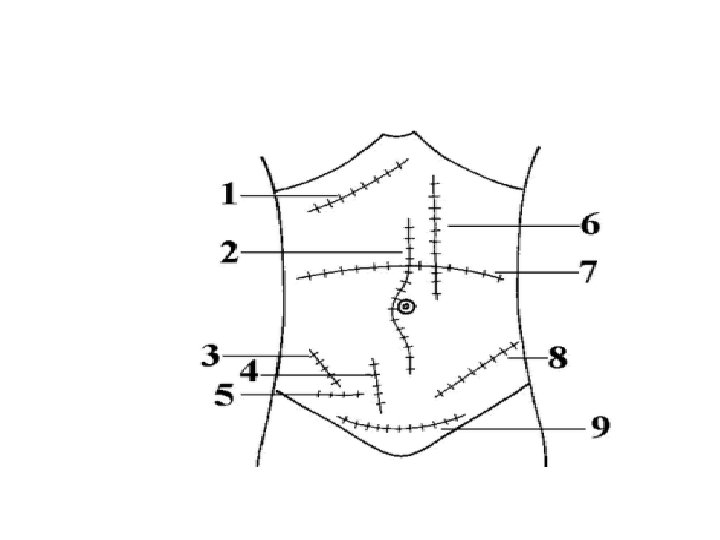 Types of incisions assist prof dr Alaa Jamel