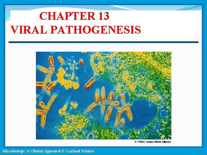 CHAPTER 13 VIRAL PATHOGENESIS CNRI Science Photo Library