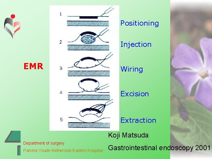 Management of large rectal adenoma Dr Hester YS