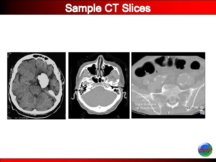 The University of Louisville CVIP Lab Medical Image