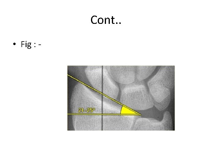 Injuries of the forearm By Dr sanjeev Normal