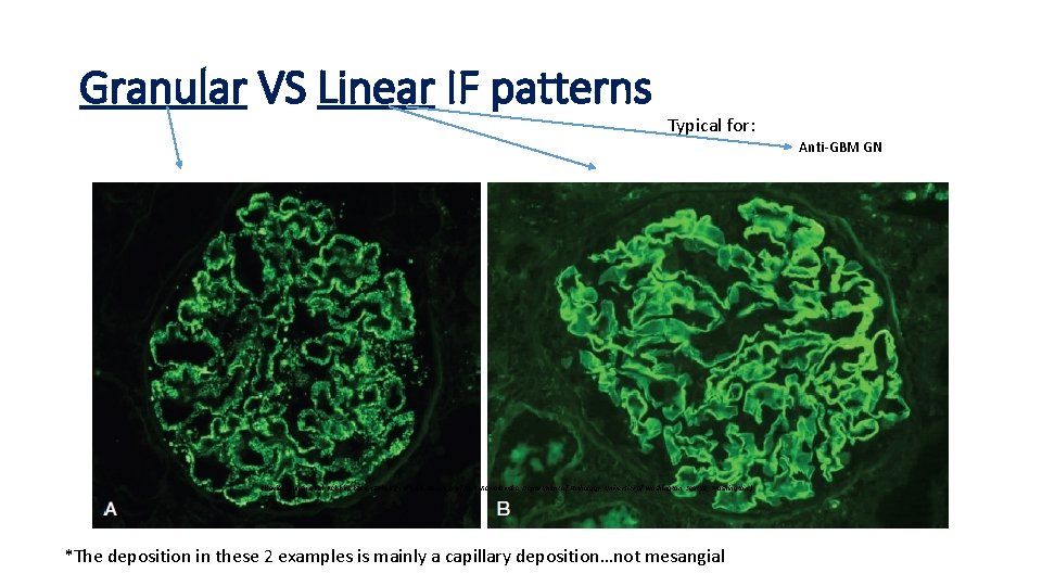 Significantly modified from Serotonin edition Overview of glomerular
