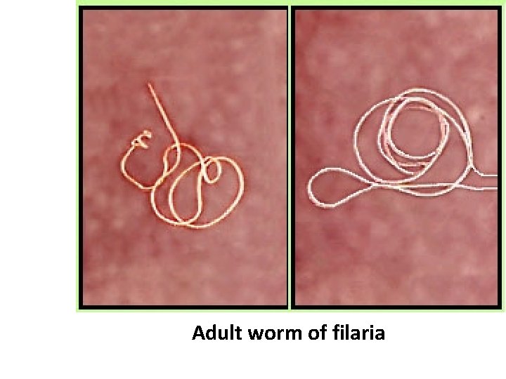 FILARIASIS paralab by l wafa menawi 2 Species