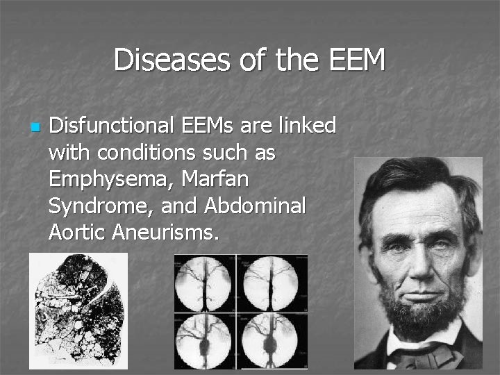 Timing and Location of the Elastic Extracellular Matrix