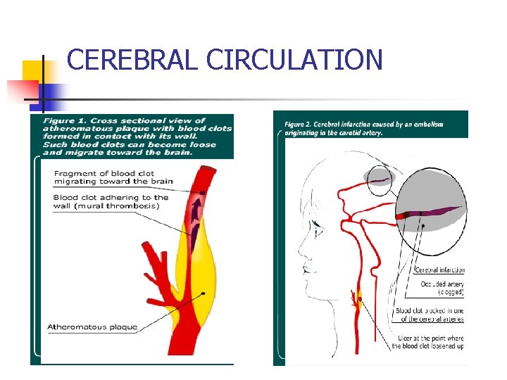 CEREBRAL CIRCULATION AND CEREBROSPINAL FLUID CSF Sultan Ayoub
