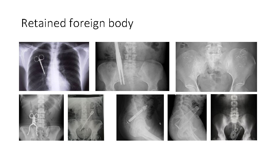 Medicolegal issues in General Surgery Mr Mark Duxbury