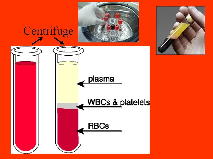 Why is blood so important to survival Bleeding