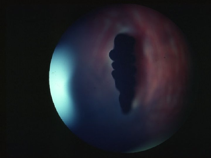 PHYL 2027 Saccadic Oscillations and the Avian Pecten