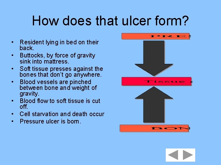 PRESSURE ULCER PROGRAM Developed by HELEN HOLDER RN