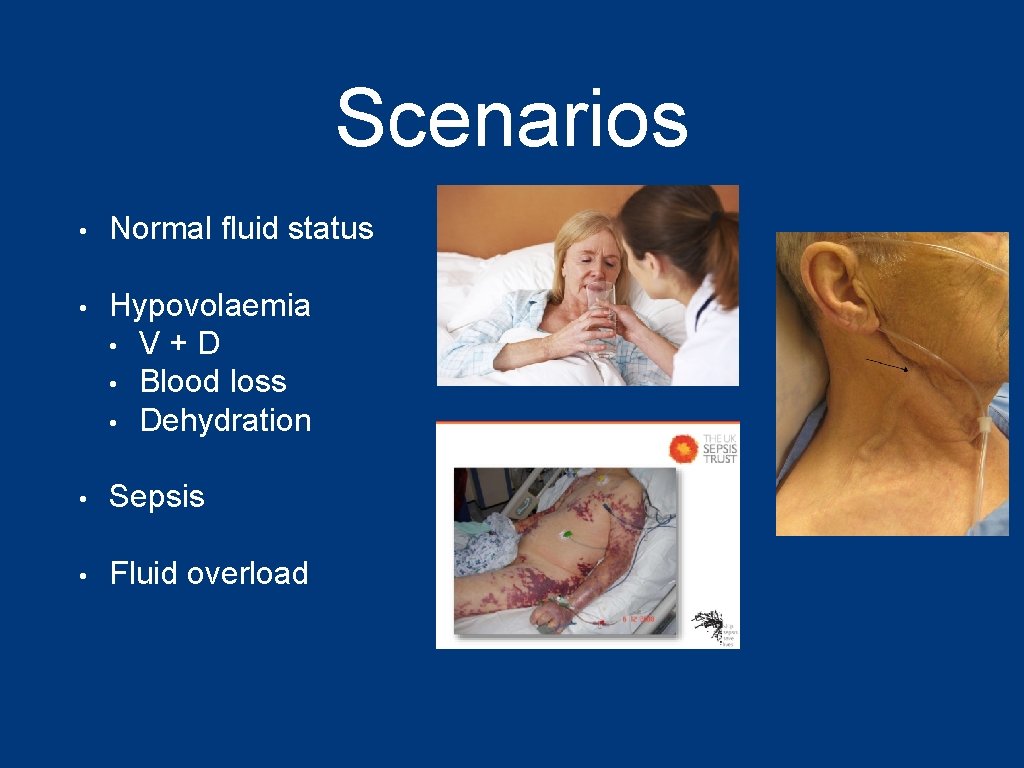 Fluid Balance Daniel Jones Learning Objectives To cover