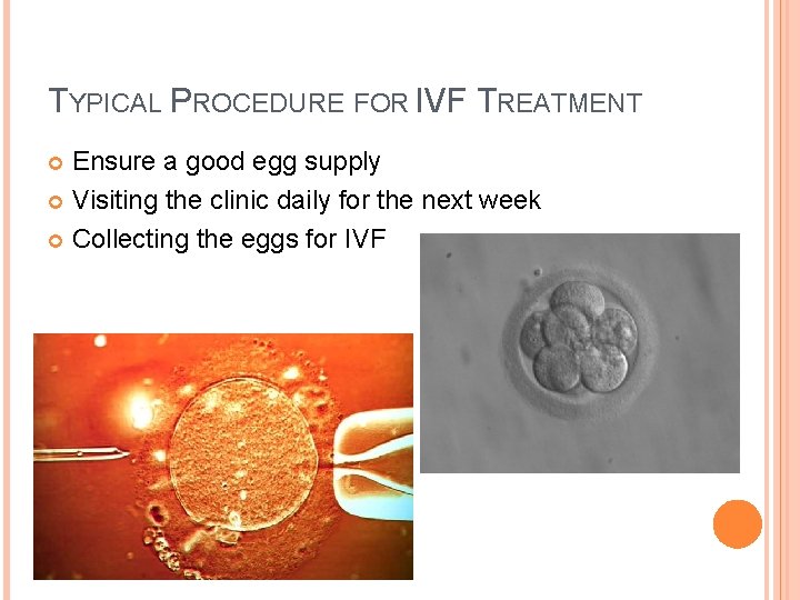 SURROGATE MOTHERHOOD AND IVF Presentation by Mary Rose