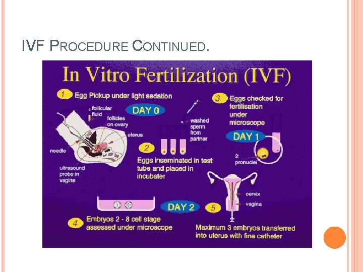 SURROGATE MOTHERHOOD AND IVF Presentation by Mary Rose