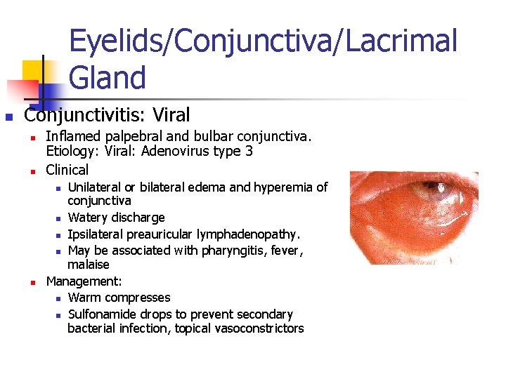 Board Review Ophthalmology By Stacey SingerLeshinsky RPAC Vision