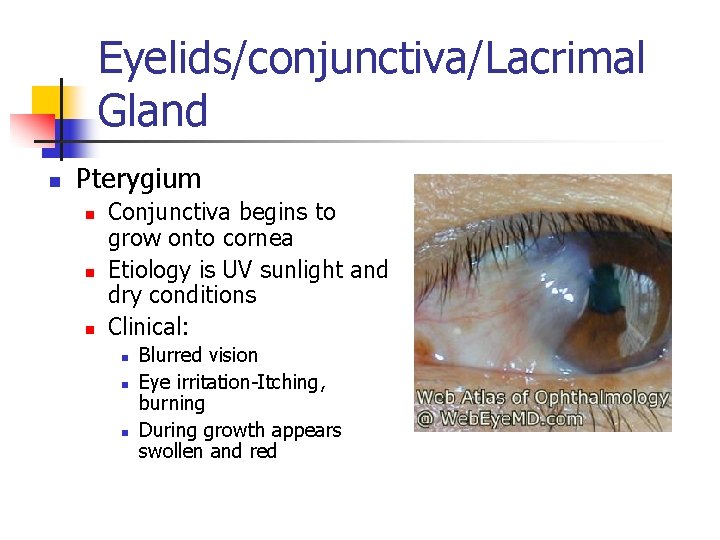 Board Review Ophthalmology By Stacey SingerLeshinsky RPAC Vision