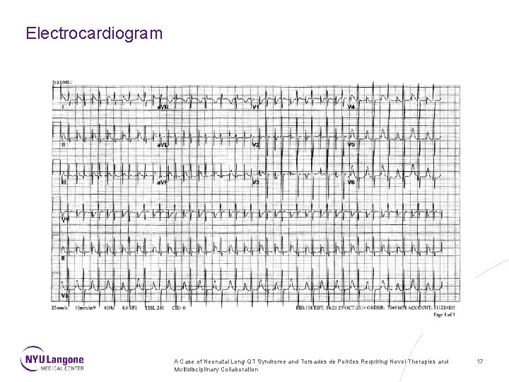 A Case of Neonatal Long QT Syndrome and