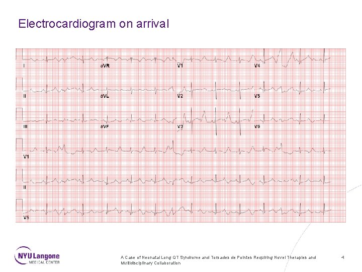 A Case of Neonatal Long QT Syndrome and