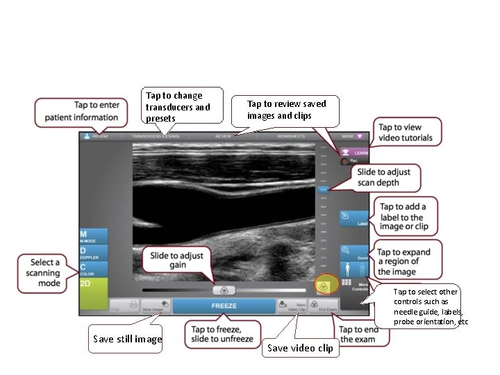 Sonosite XPorte Orientation Katie Colpitts Regional Emergency Ultrasound