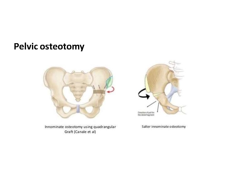 LeggCalvPerthes disease 882019 Learning objectives It is a